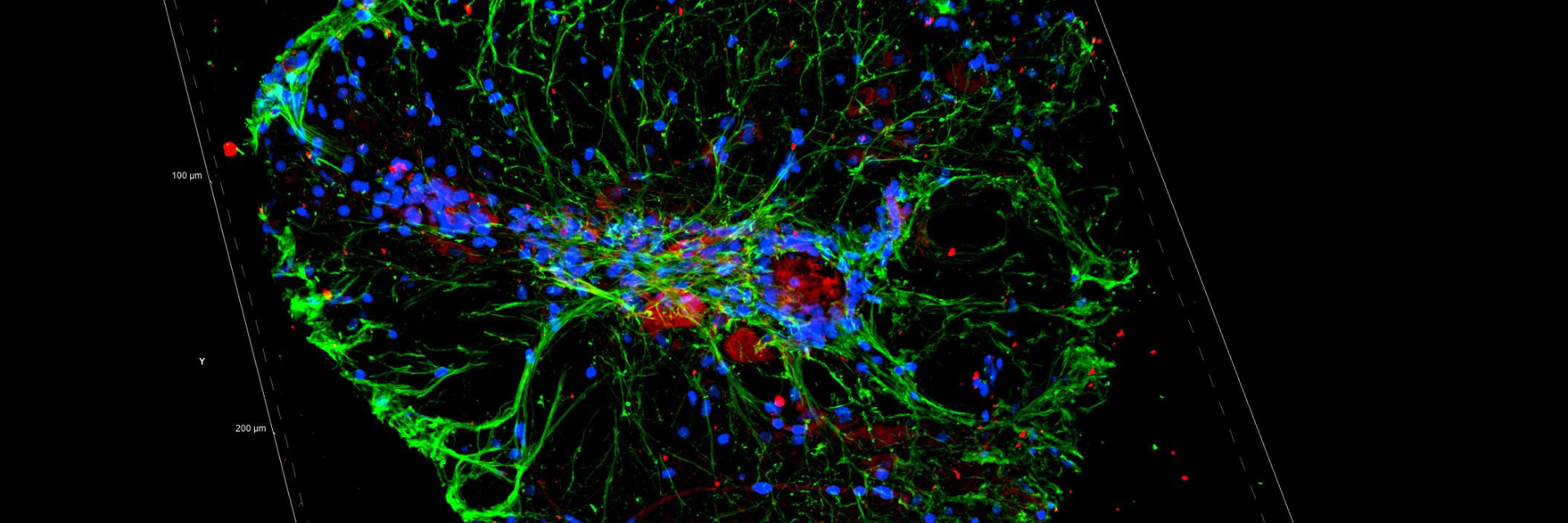 Collaborative Specialization in Neuroscience | University of Guelph